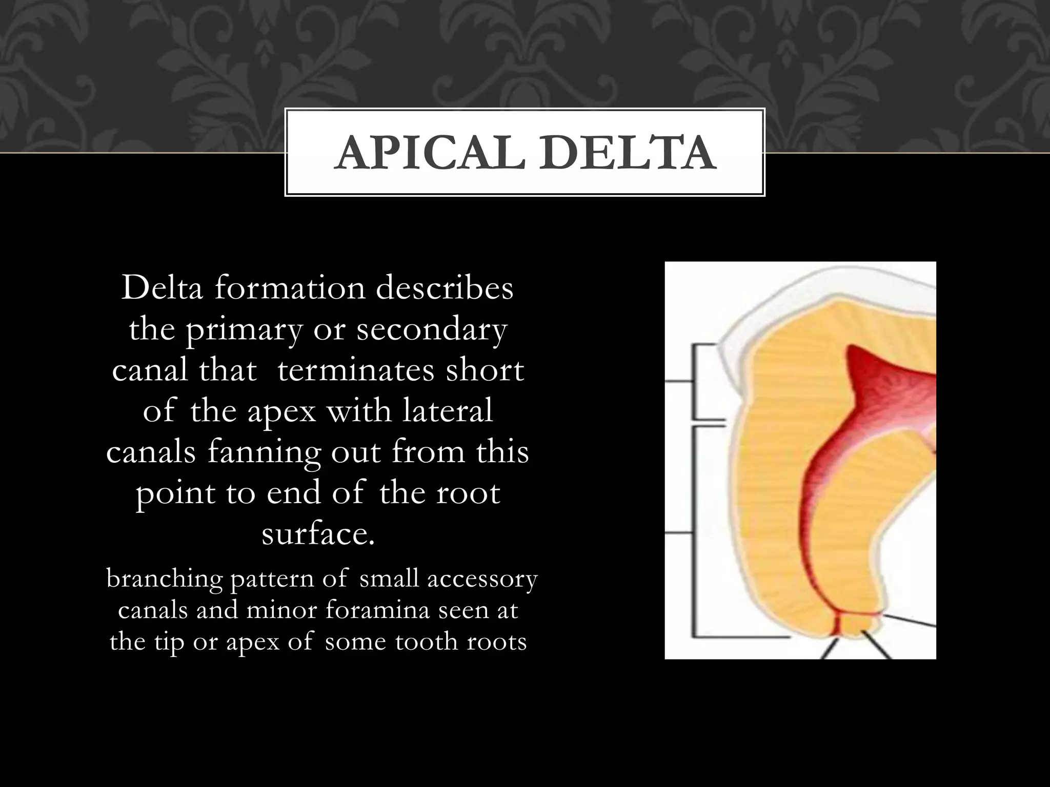 Anatomy of the pulp space and access cavity | PPTX