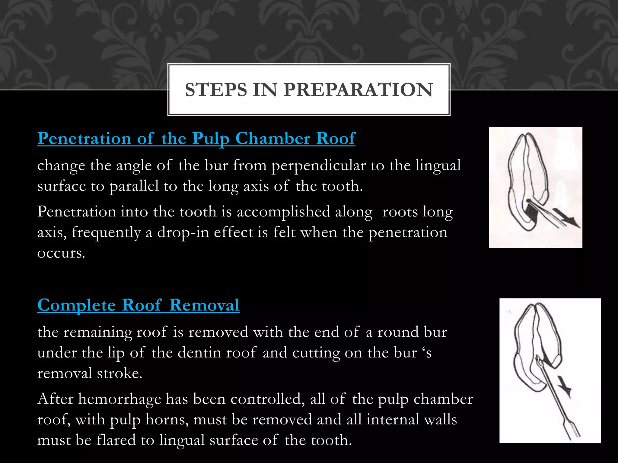 Anatomy of the pulp space and access cavity | PPTX