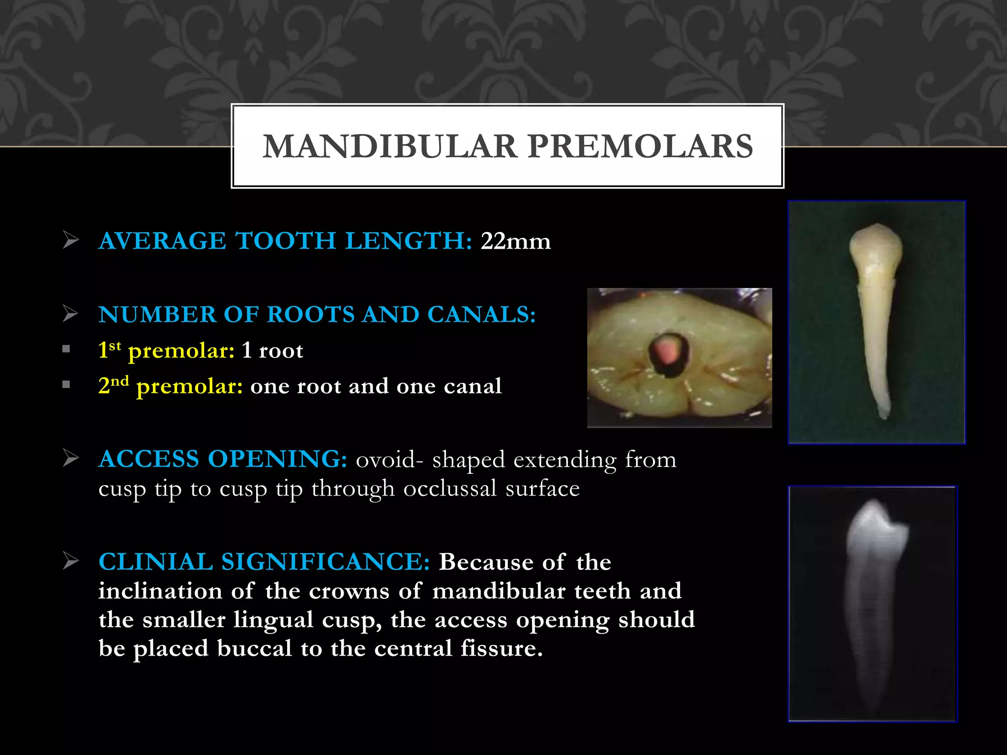 Anatomy of the pulp space and access cavity | PPTX