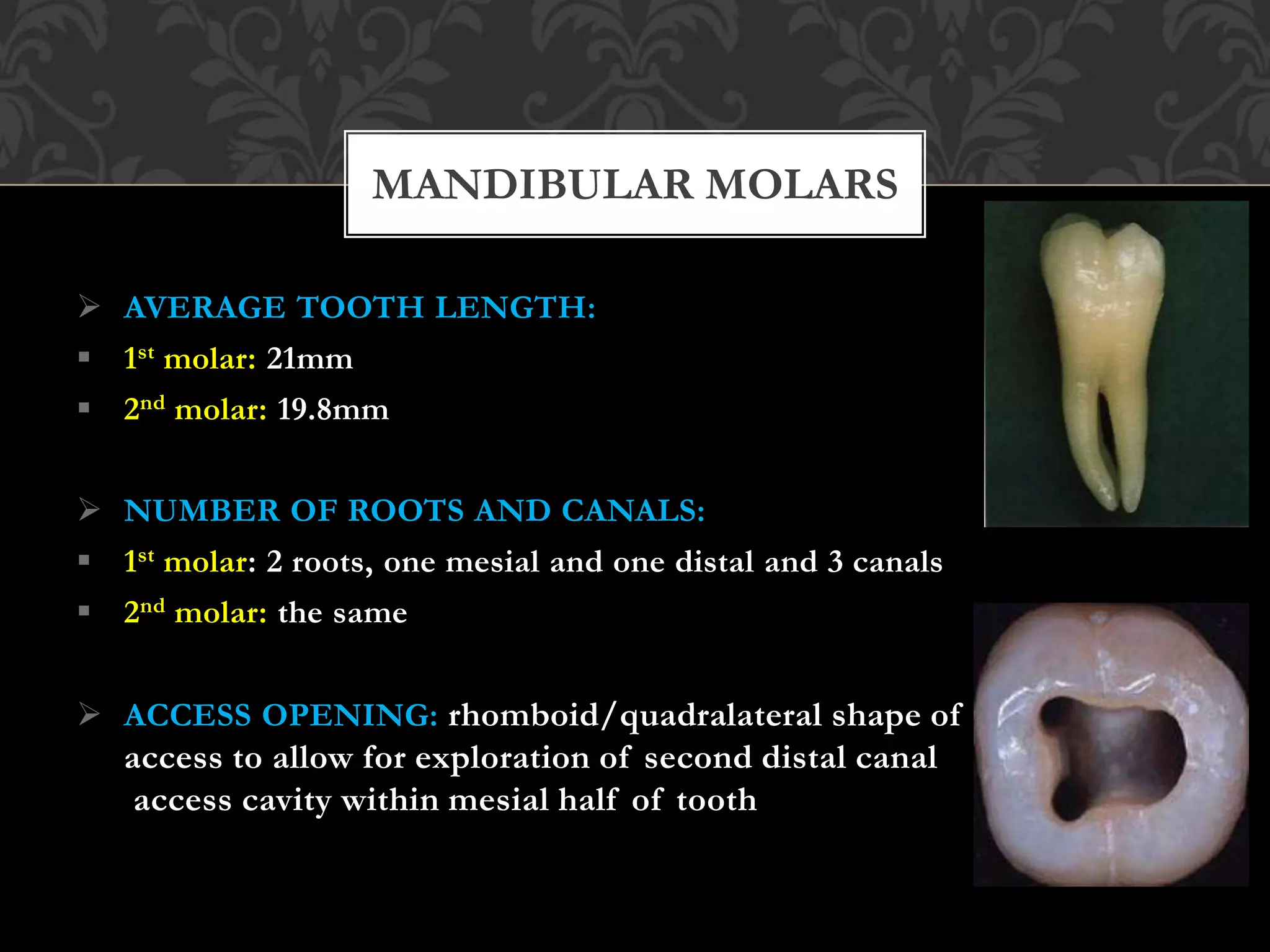 Anatomy of the pulp space and access cavity | PPTX
