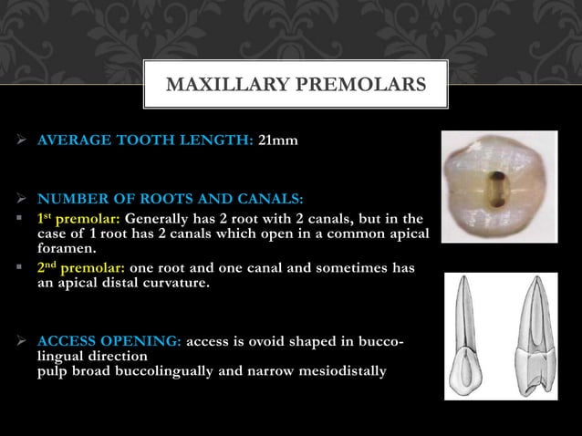 Anatomy of the pulp space and access cavity | PPTX | Dental Health ...