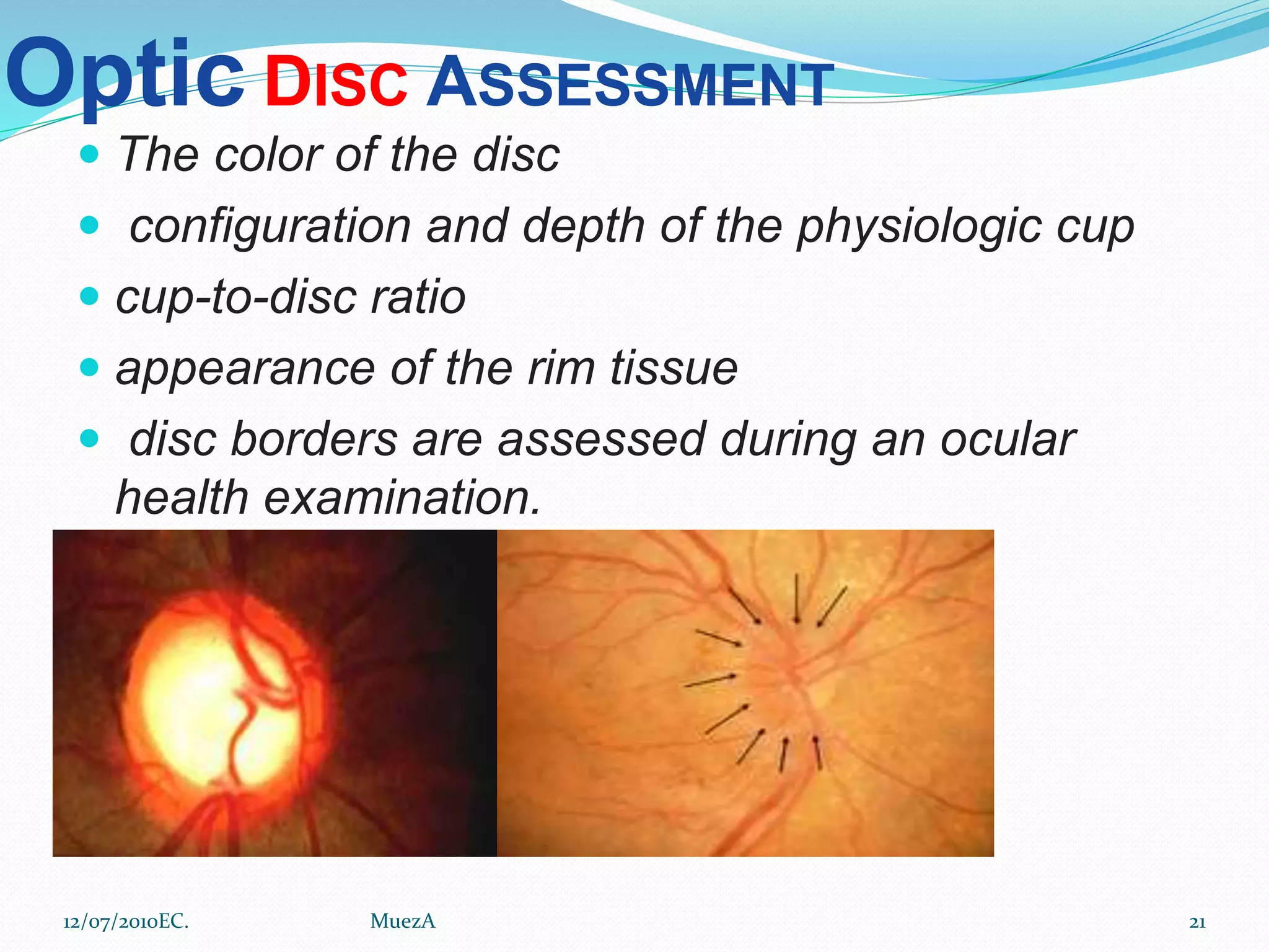 Anatomy of the Retina.pptx