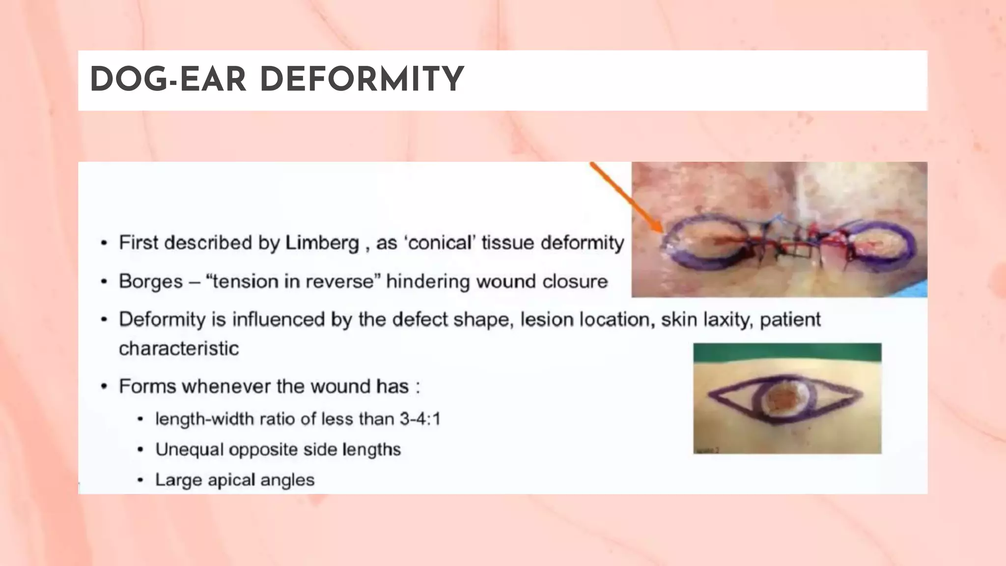 Anatomy of the Skin Basics of Cutting and Suturing.pptx