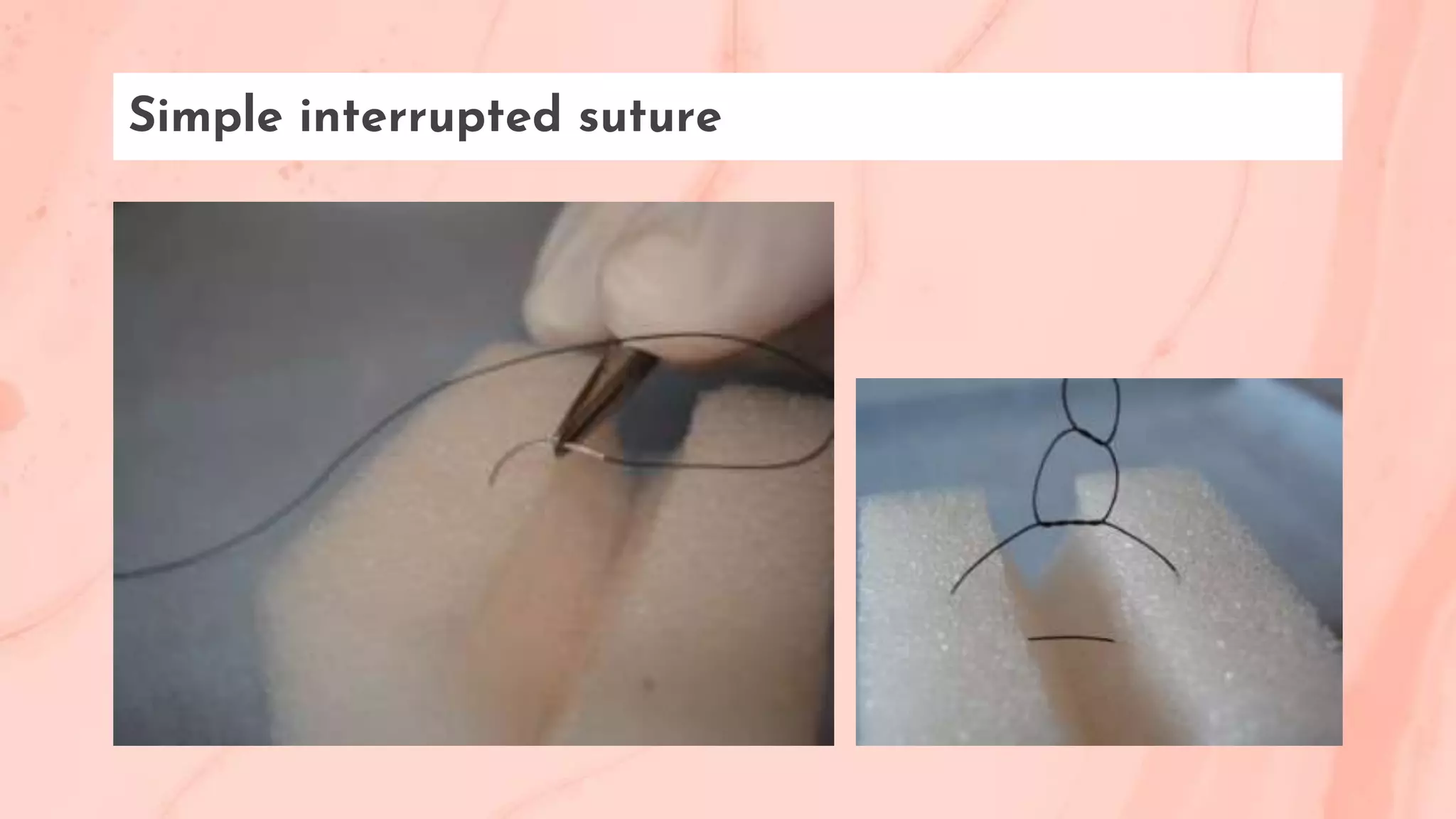 Anatomy of the Skin Basics of Cutting and Suturing.pptx