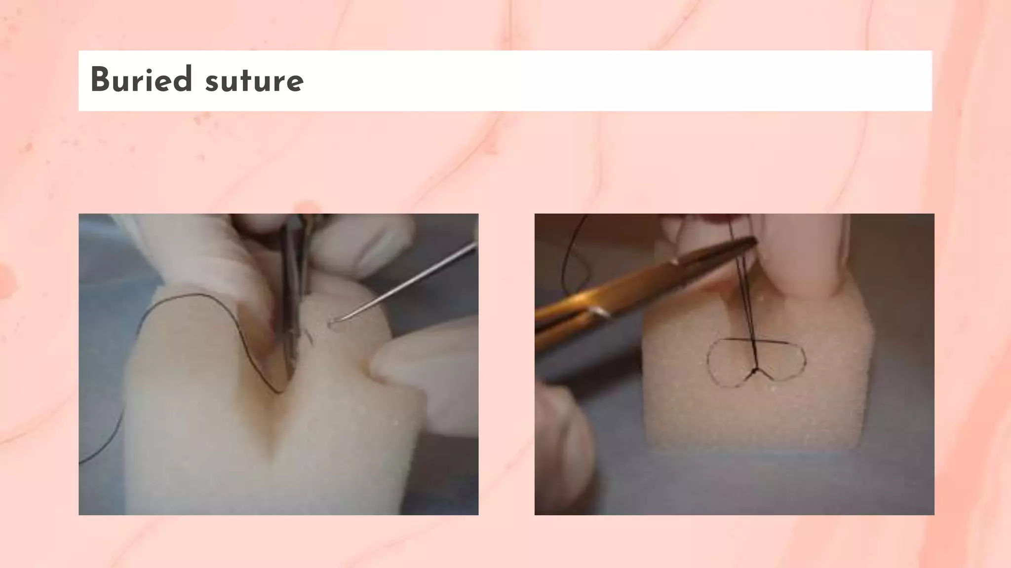 Anatomy of the Skin Basics of Cutting and Suturing.pptx