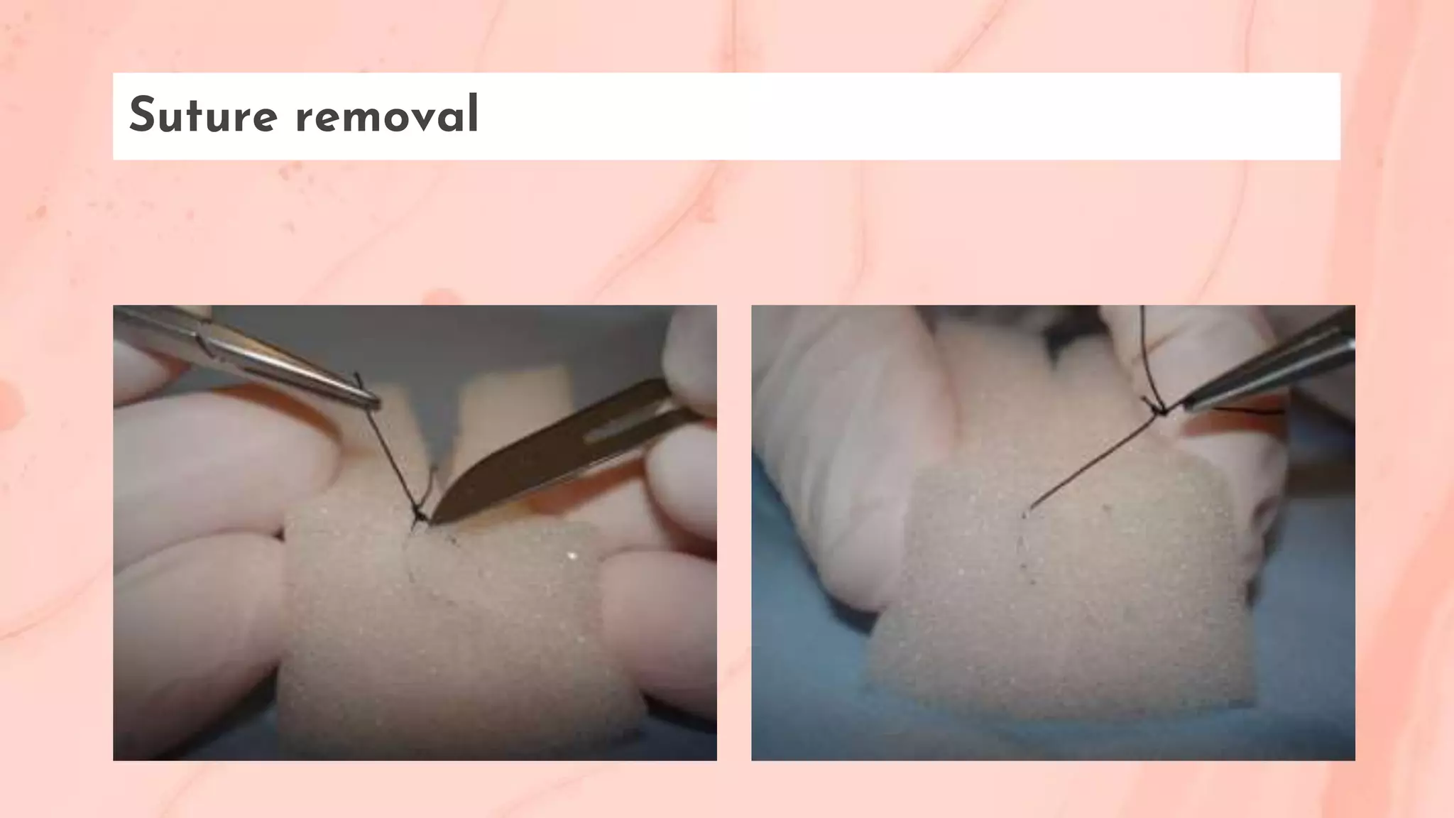 Anatomy of the Skin Basics of Cutting and Suturing.pptx