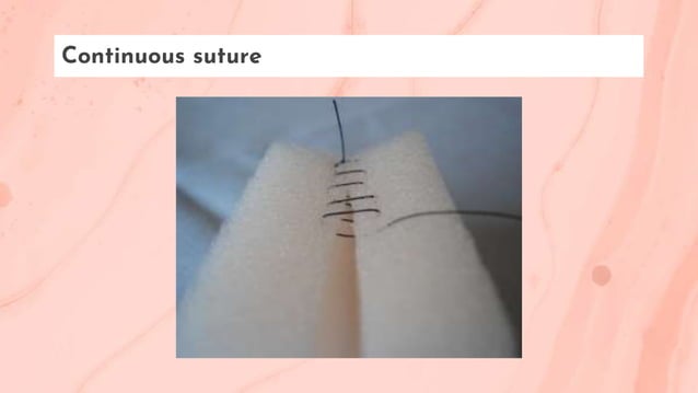 Anatomy of the Skin Basics of Cutting and Suturing.pptx