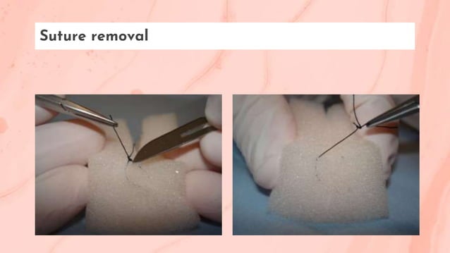 Anatomy of the Skin Basics of Cutting and Suturing.pptx