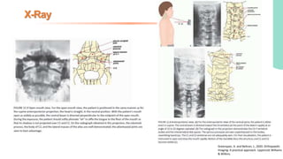 Anatomy of The Spine (1).pptx