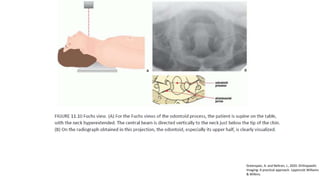 Anatomy of The Spine (1).pptx