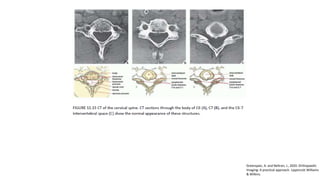 Anatomy of The Spine (1).pptx