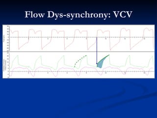 Anatomy of the ventilator | PPT