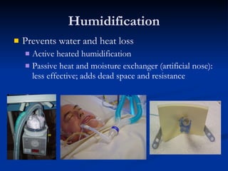 Anatomy of the ventilator | PPT