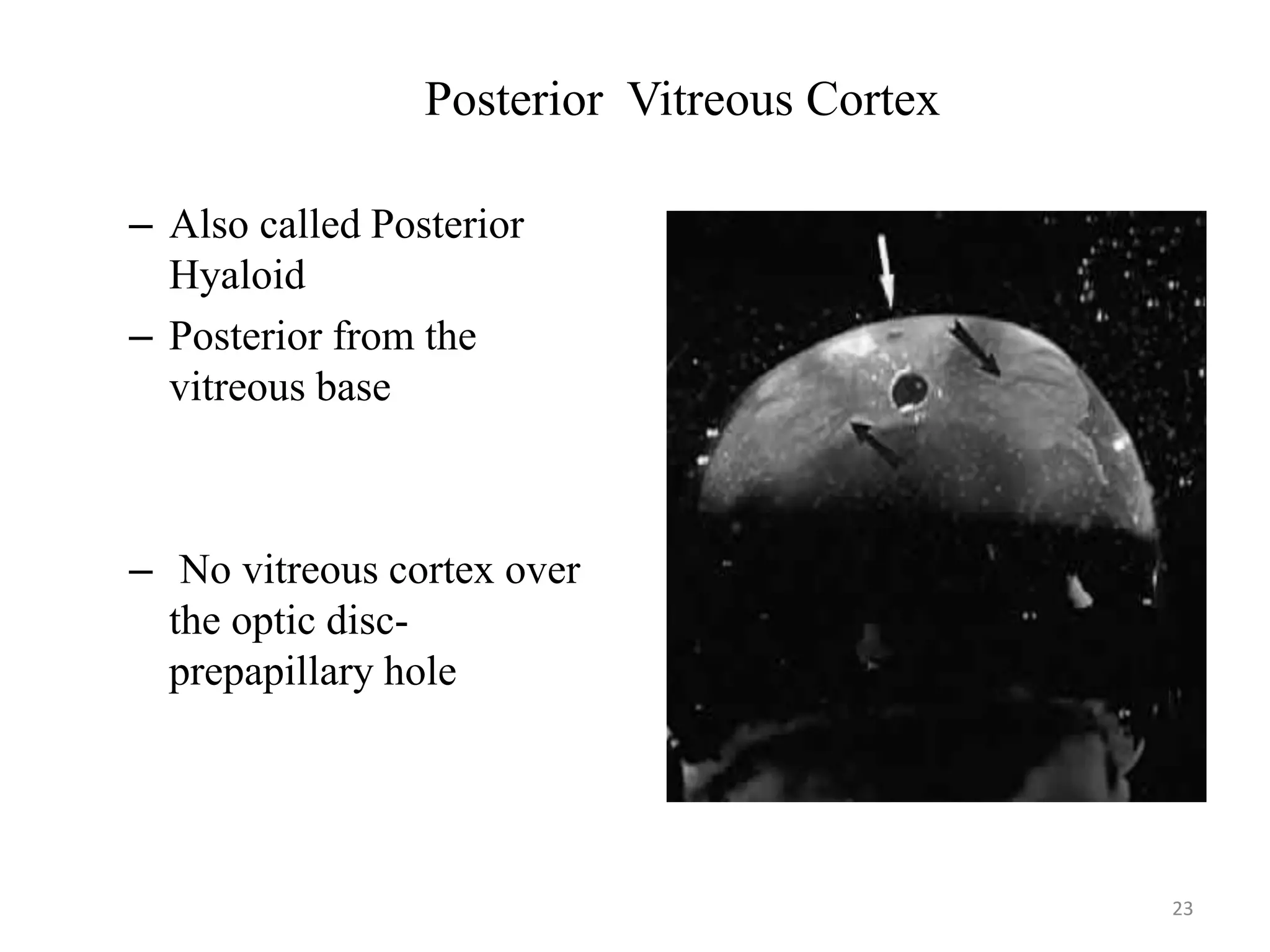Anatomy of the vitreous body | PPTX