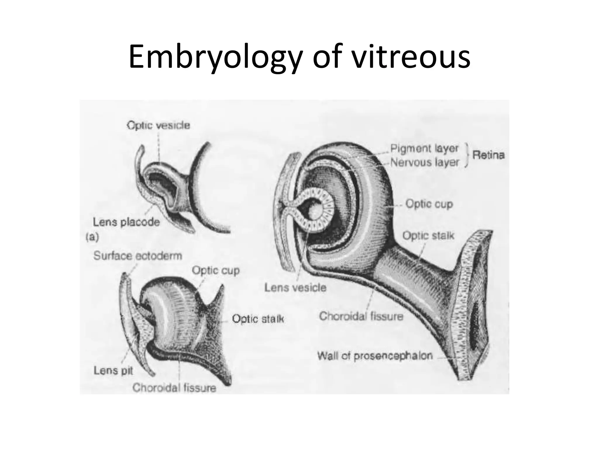 Anatomy of the vitreous body | PPTX