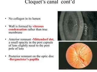 Anatomy of the vitreous body | PPTX