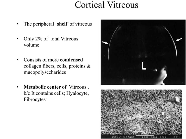 Anatomy of the vitreous body | PPTX | Eye and Vision Conditions ...