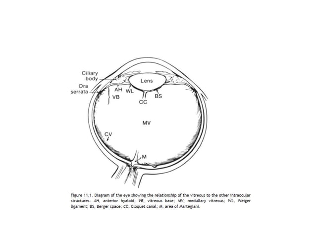 Anatomy of the vitreous body | PPTX | Eye and Vision Conditions ...