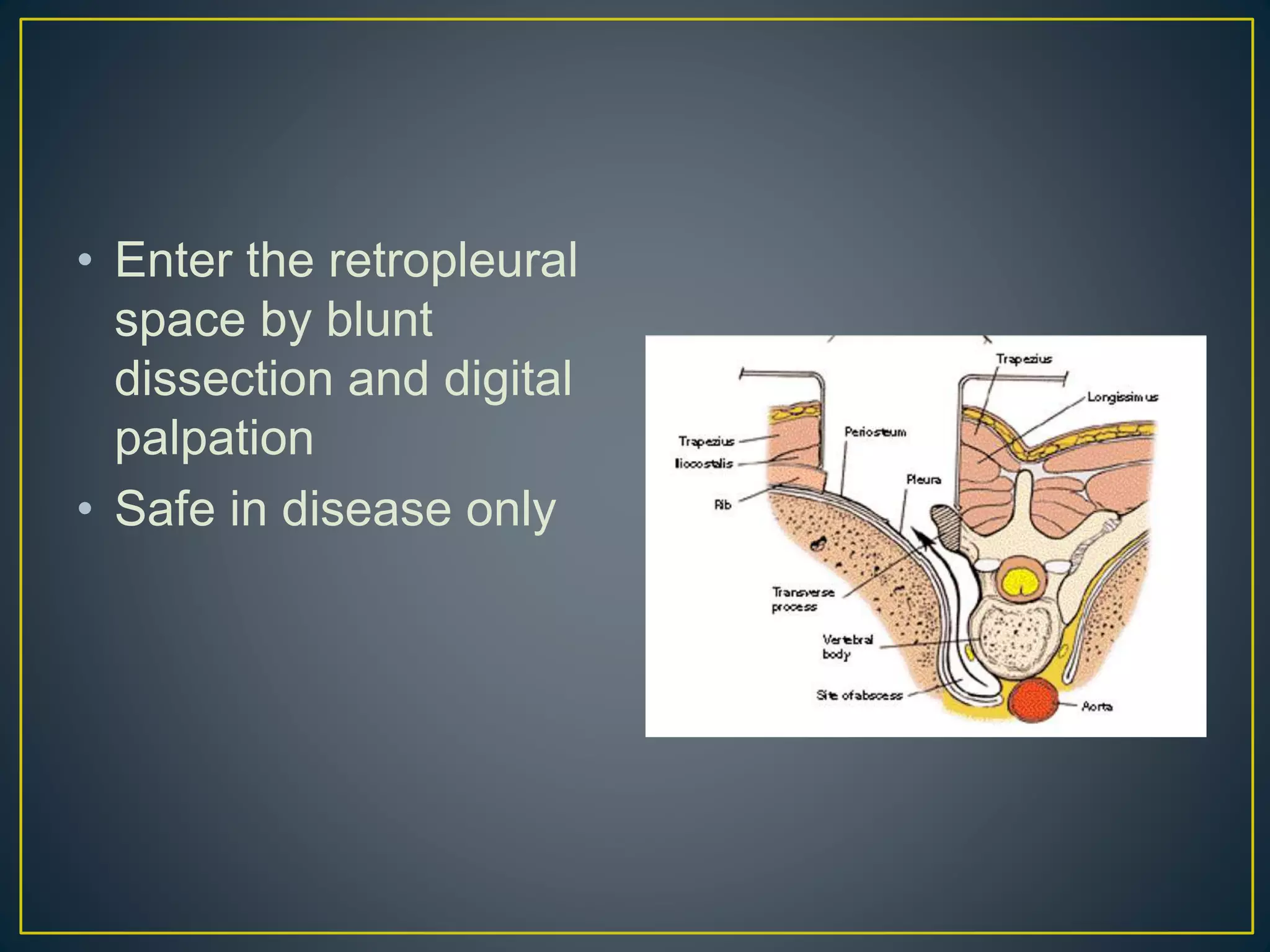 Anatomy of thoracic vertebra | PPTX