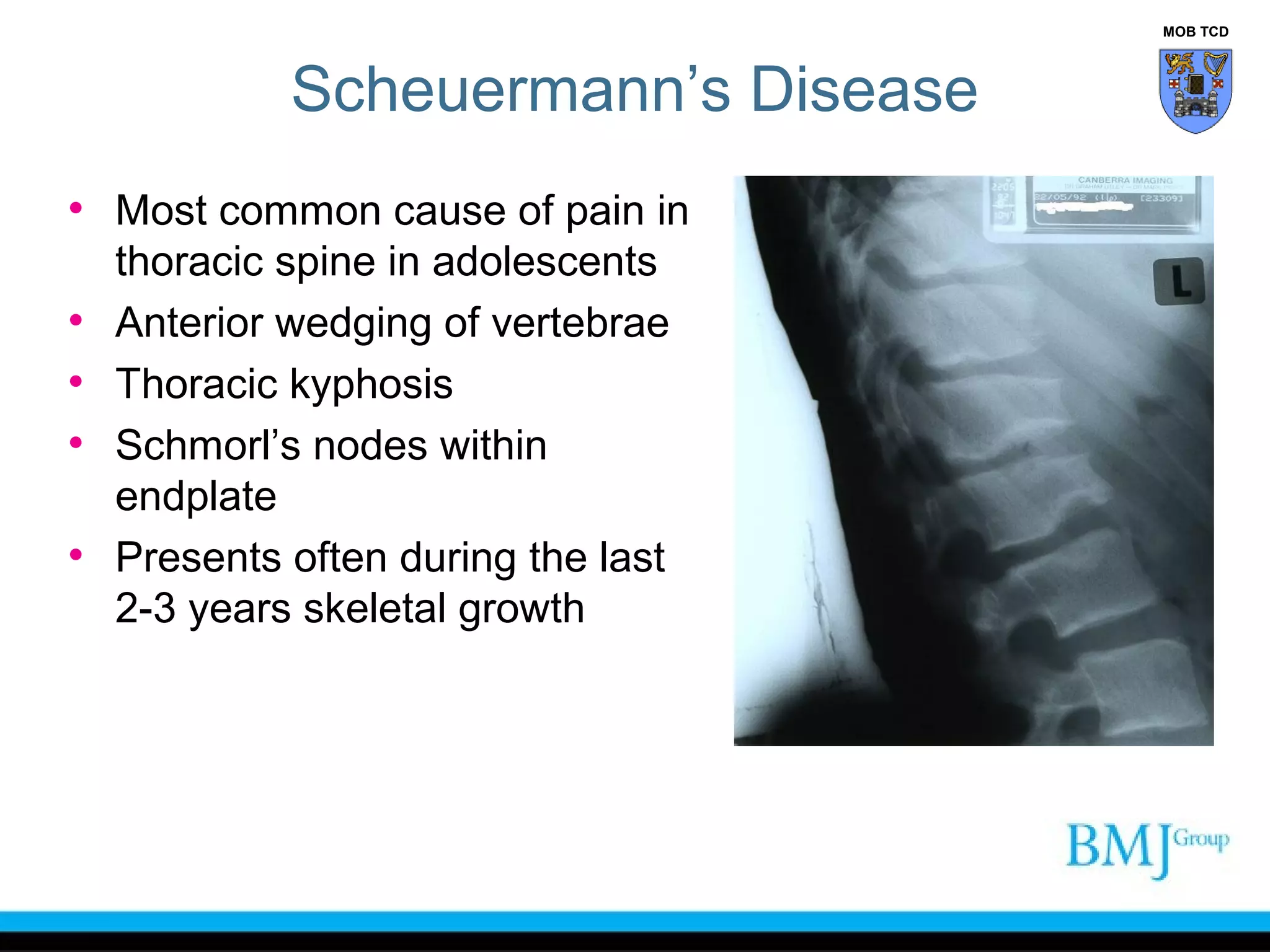 Anatomy of thoraco lumbar vertabrae (www.Am-medicine.com) | PPT