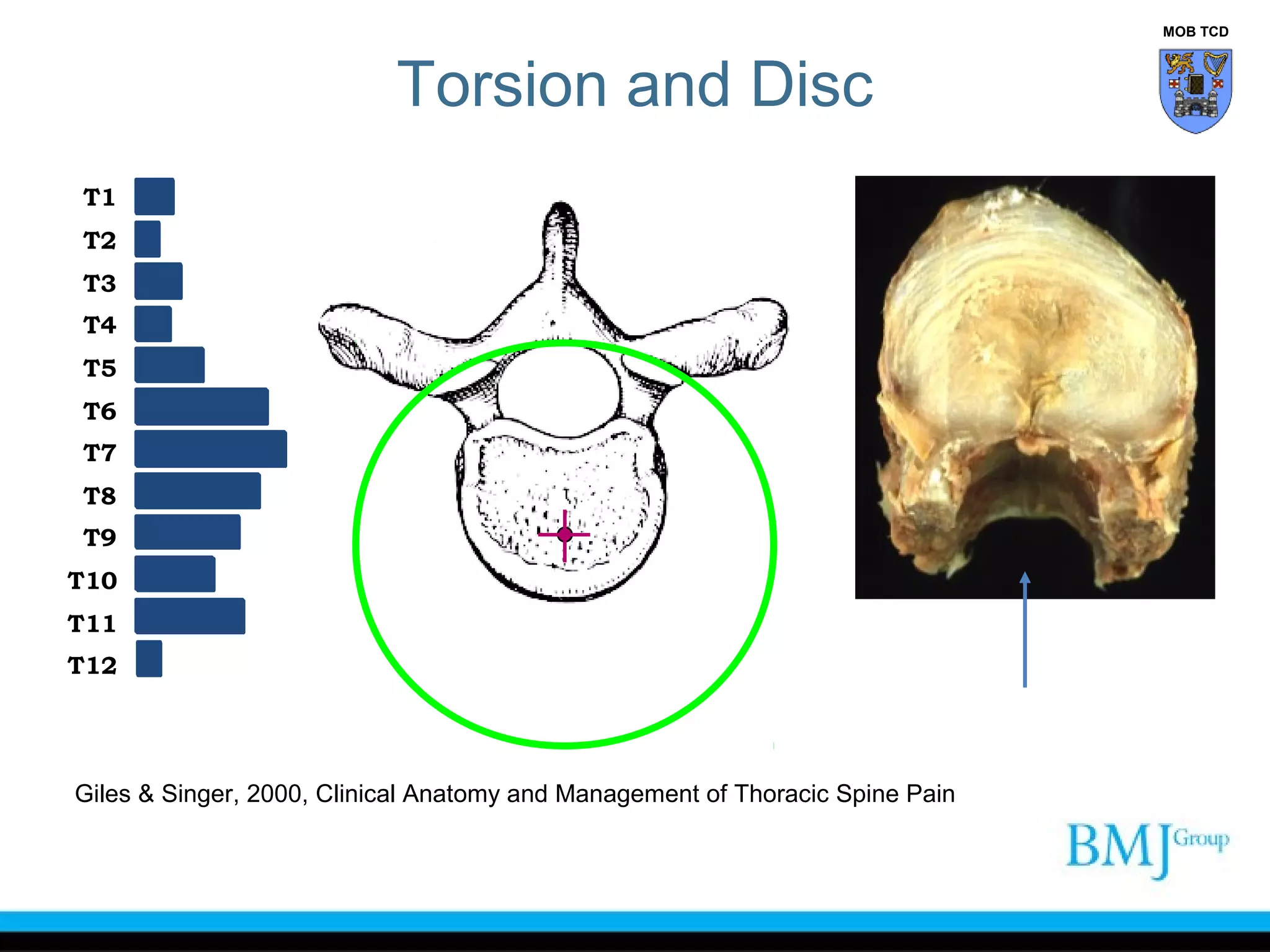 Anatomy of thoraco lumbar vertabrae (www.Am-medicine.com) | PPT