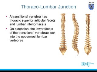 Anatomy of thoraco lumbar vertabrae (www.Am-medicine.com) | PPT