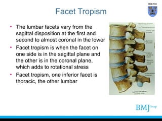 Anatomy of thoraco lumbar vertabrae (www.Am-medicine.com) | PPT