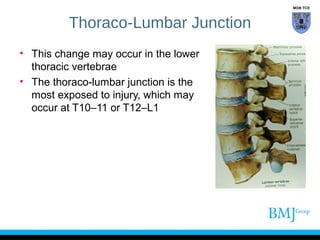 Anatomy of thoraco lumbar vertabrae (www.Am-medicine.com) | PPT