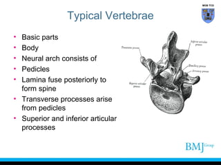 Anatomy of thoraco lumbar vertabrae (www.Am-medicine.com) | PPT