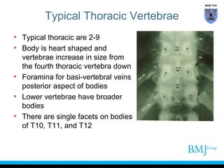 Anatomy of thoraco lumbar vertabrae (www.Am-medicine.com) | PPT