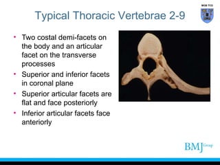 Anatomy of thoraco lumbar vertabrae (www.Am-medicine.com) | PPT