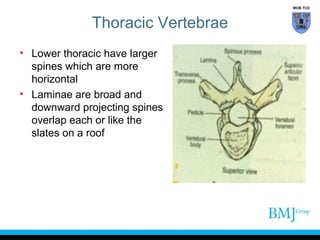 Anatomy of thoraco lumbar vertabrae (www.Am-medicine.com) | PPT