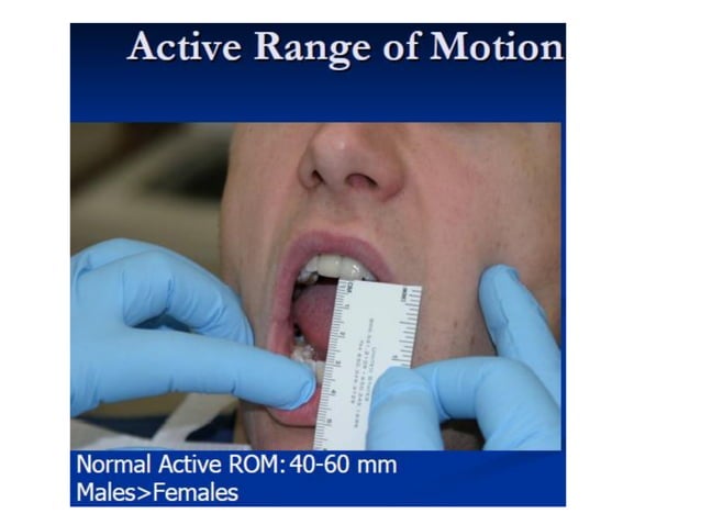 Anatomy of TMJ | PPT