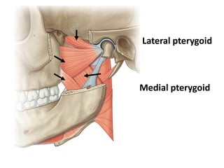 Stylomandibular Ligament