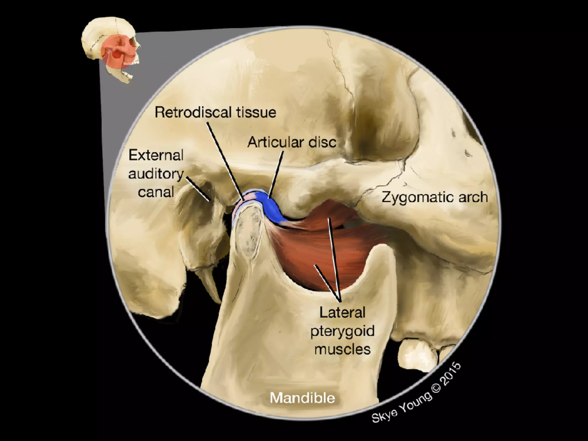Anatomy of tmj | PDF | Death, Injury, or Military Conflict | Sensitive ...