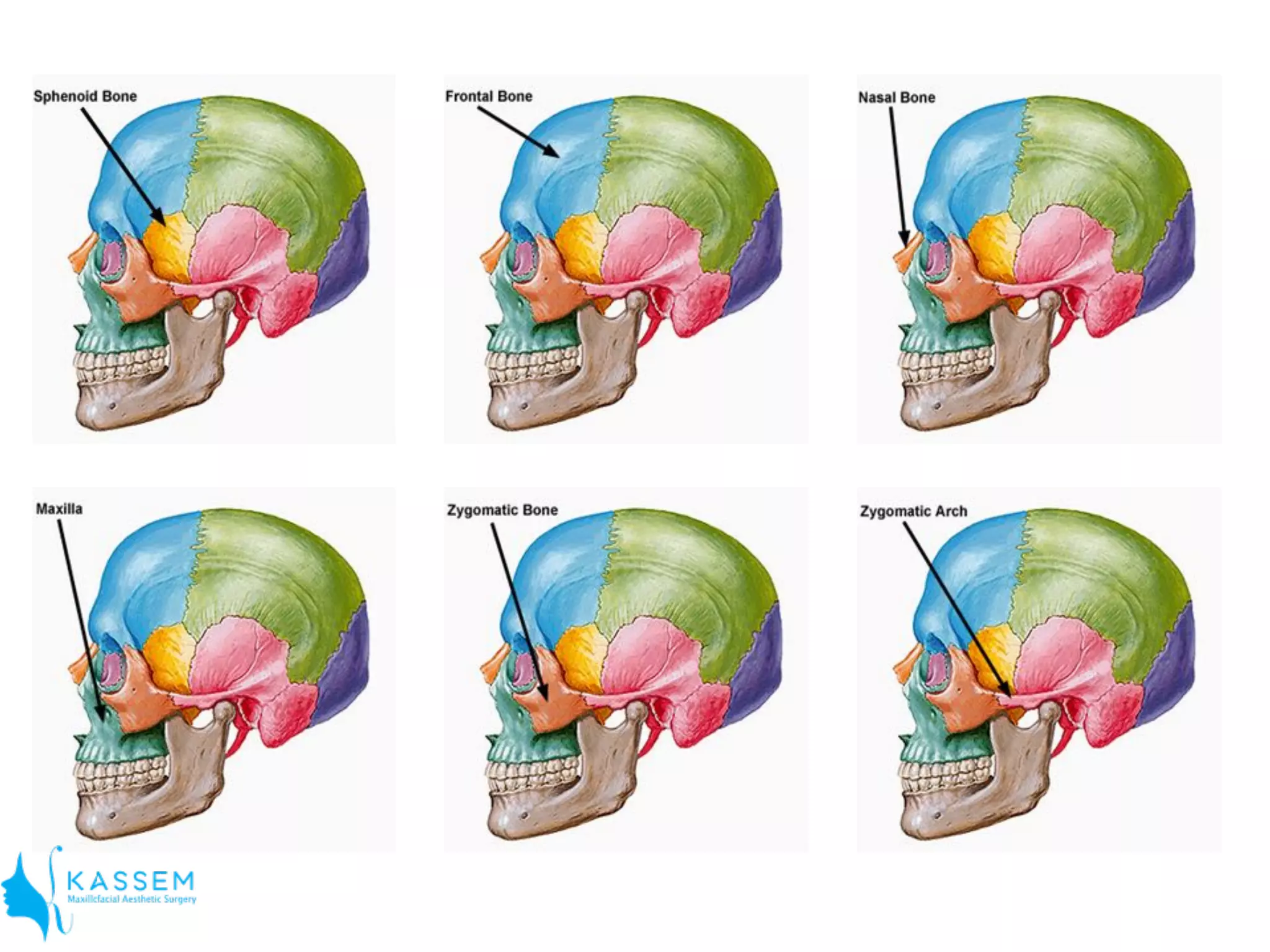 Anatomy of tmj | PDF | Death, Injury, or Military Conflict | Sensitive ...