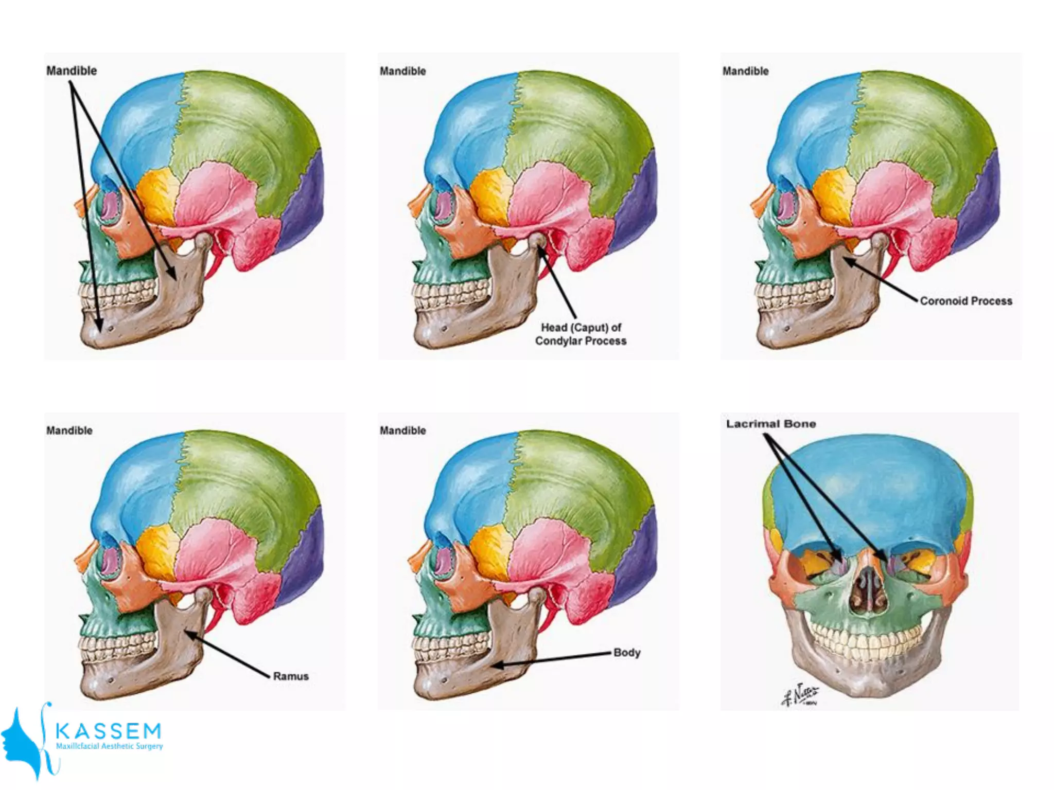 Anatomy of tmj | PDF | Death, Injury, or Military Conflict | Sensitive ...