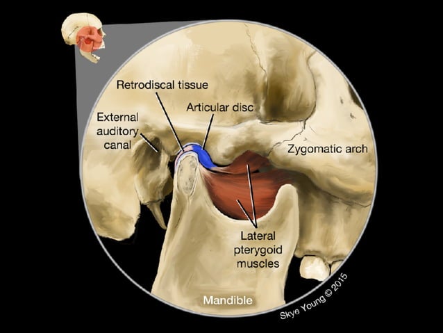 Anatomy of tmj | PDF | Death, Injury, or Military Conflict | Sensitive ...