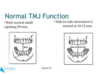 Anatomy of tmj | PDF