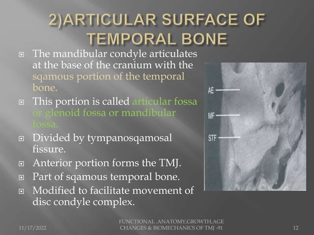 anatomy of tmj.pptx