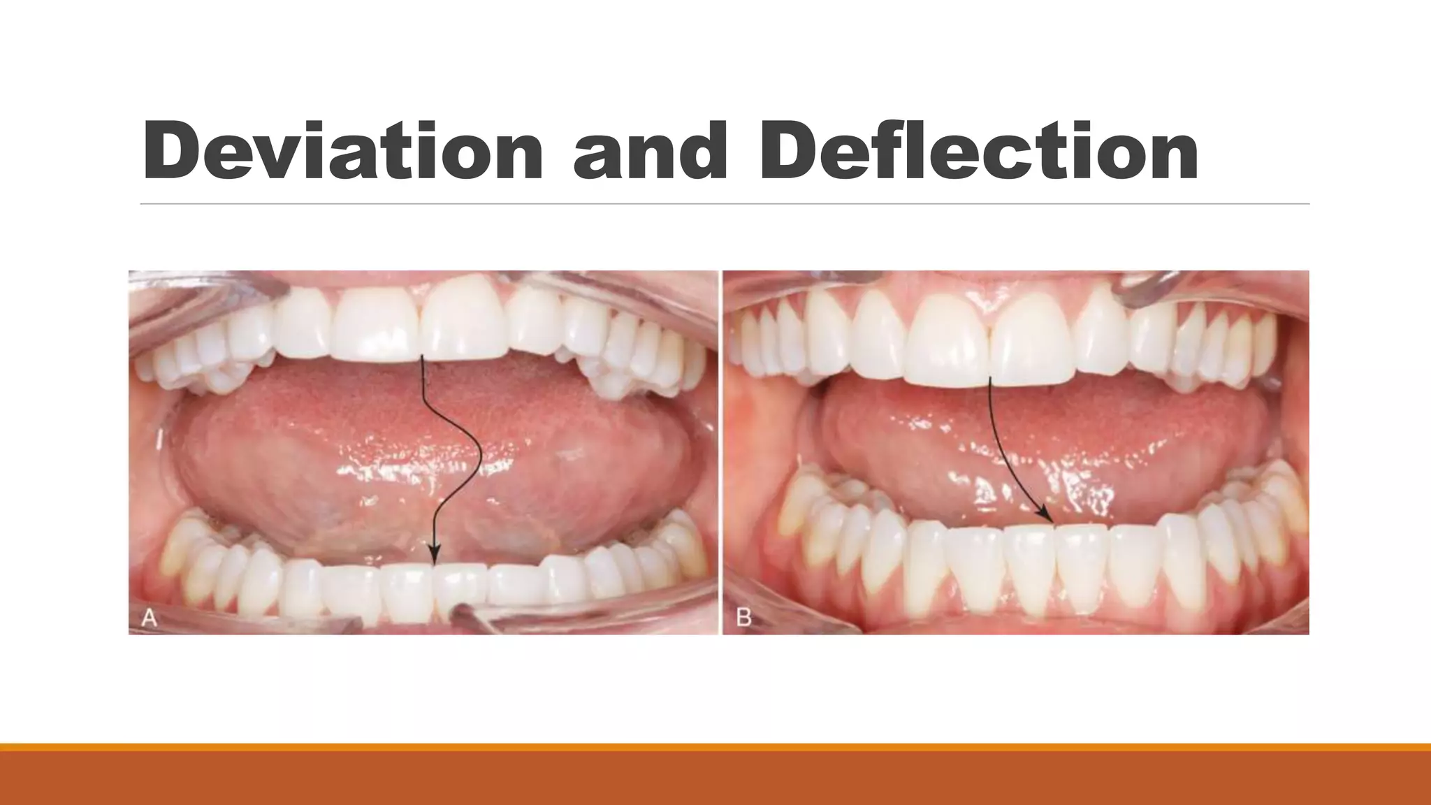 Diagnosis of TMDs and General therapy.pptx