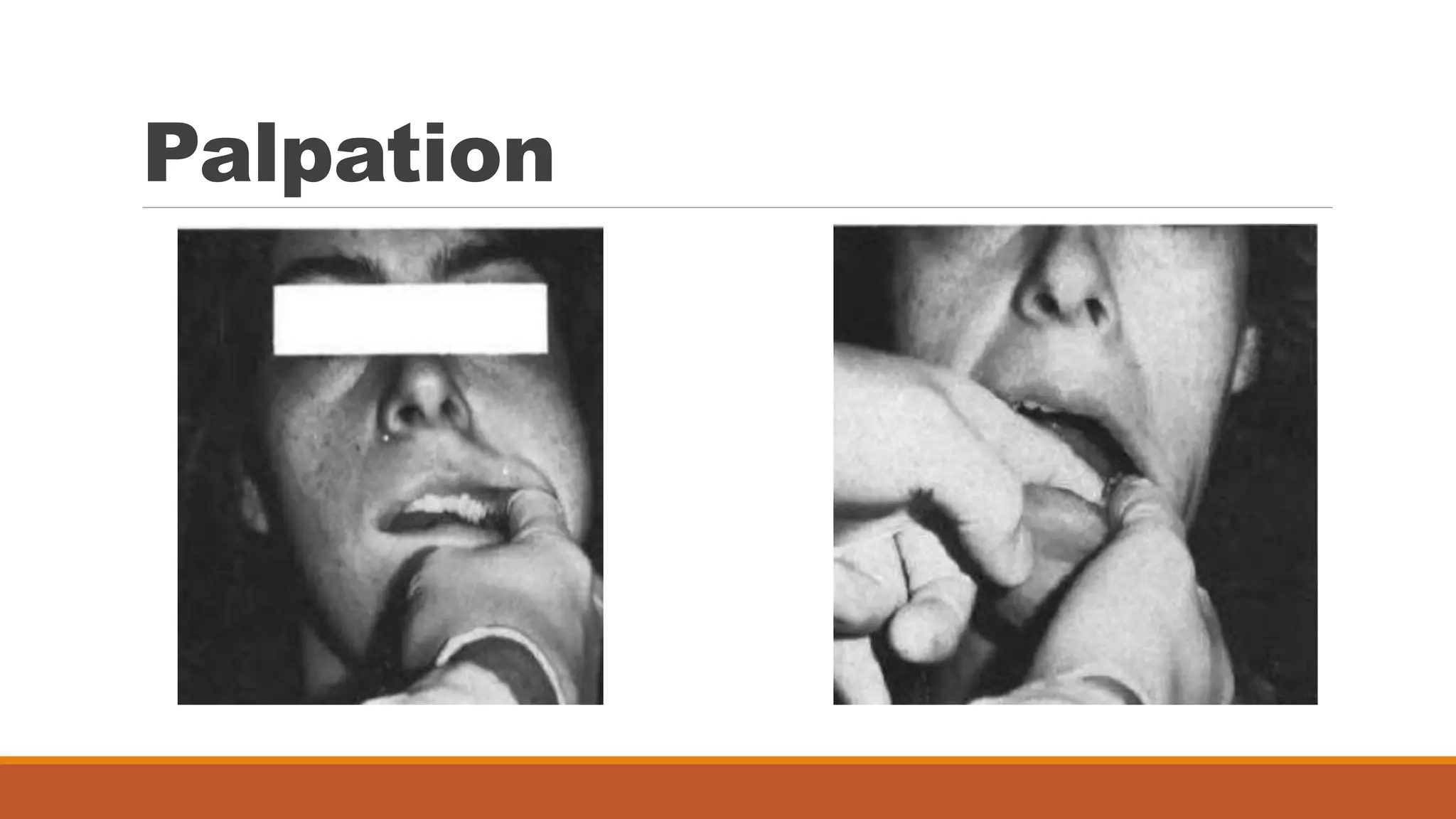 Diagnosis of TMDs and General therapy.pptx