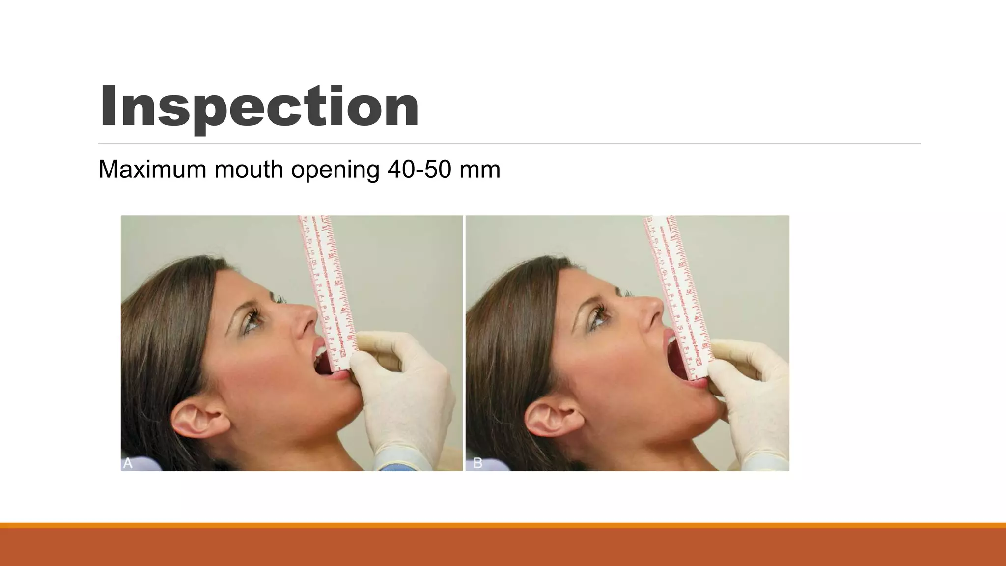 Diagnosis of TMDs and General therapy.pptx