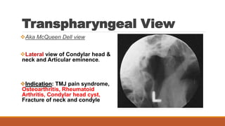 Diagnosis of TMDs and General therapy.pptx