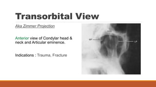 Diagnosis of TMDs and General therapy.pptx