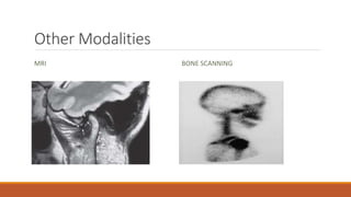 Diagnosis of TMDs and General therapy.pptx