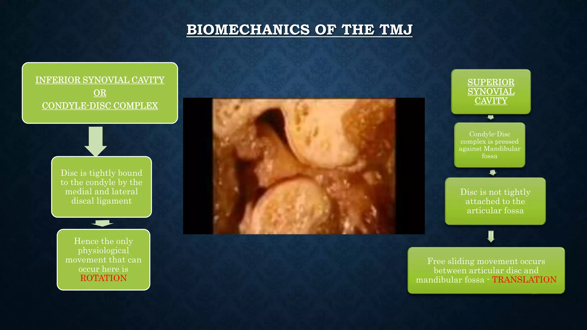 ANATOMY OF TMJ AND ITS ROLE IN PROSTHODONTICS.pptx