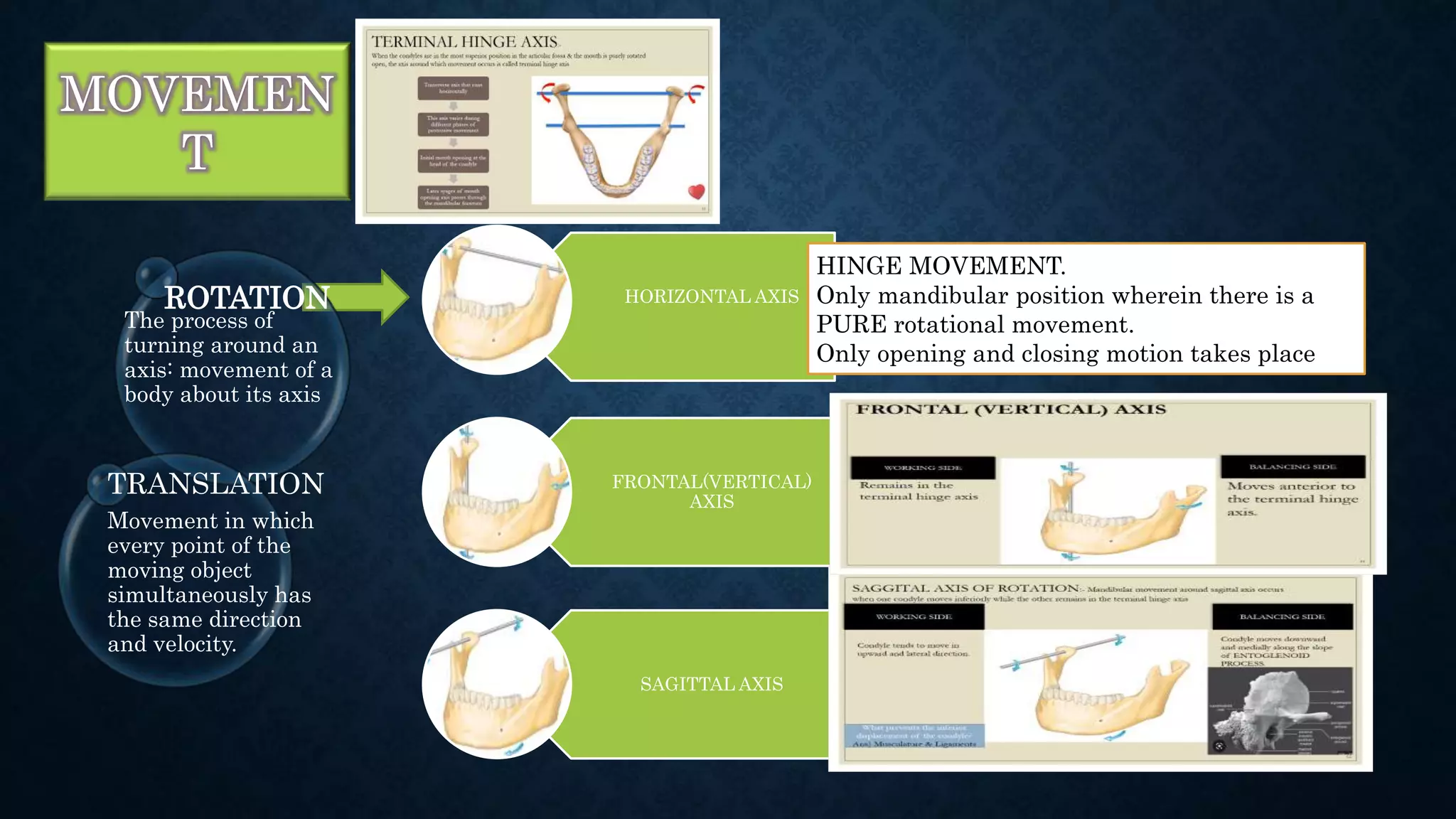 ANATOMY OF TMJ AND ITS ROLE IN PROSTHODONTICS.pptx