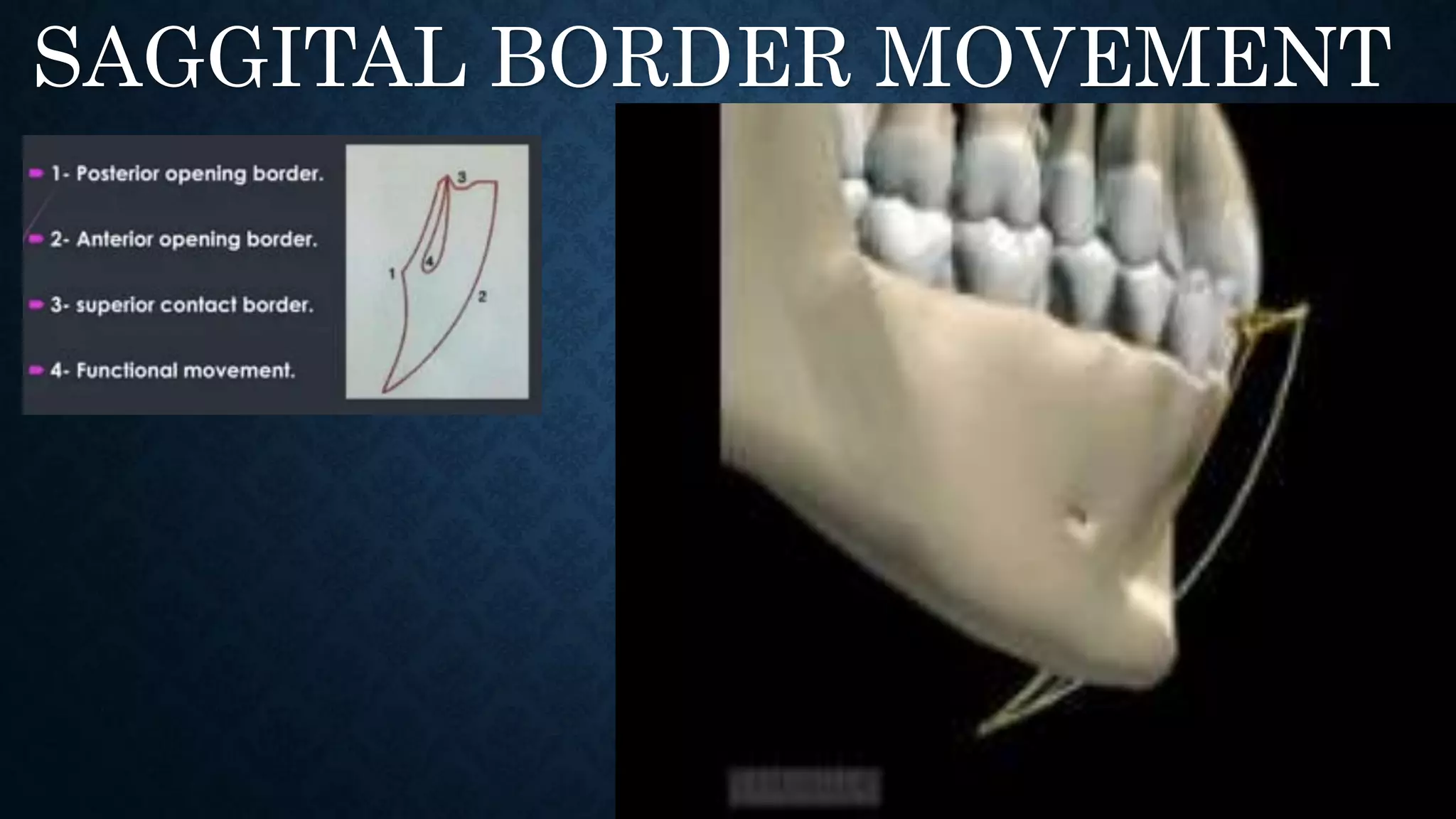 ANATOMY OF TMJ AND ITS ROLE IN PROSTHODONTICS.pptx | Bone and Joint ...