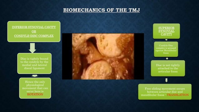 ANATOMY OF TMJ AND ITS ROLE IN PROSTHODONTICS.pptx | Bone and Joint ...